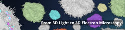 From 3D Light to 3D Electron Microscopy 2024 Ghent